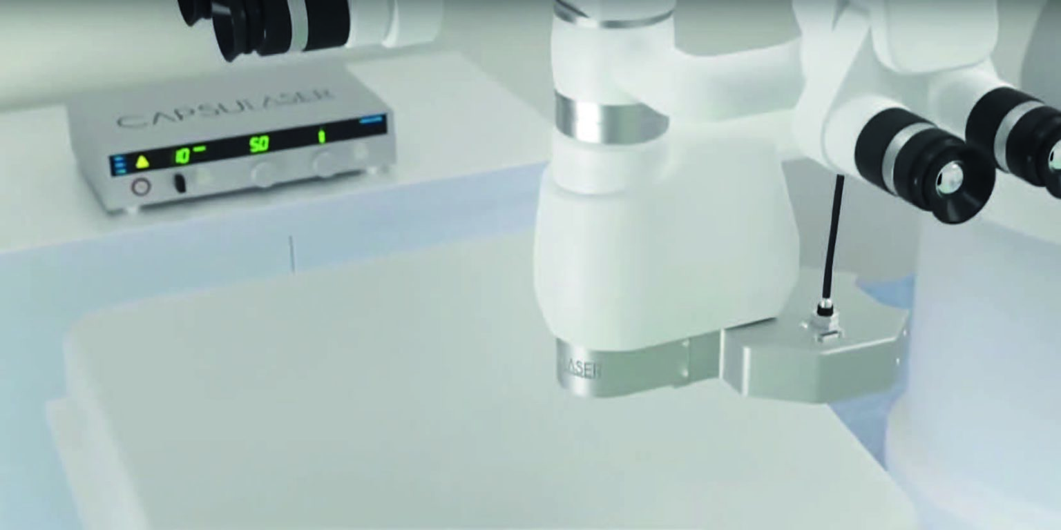 Katarakt Laser zur Kapsulotomie - Polytech Domilens